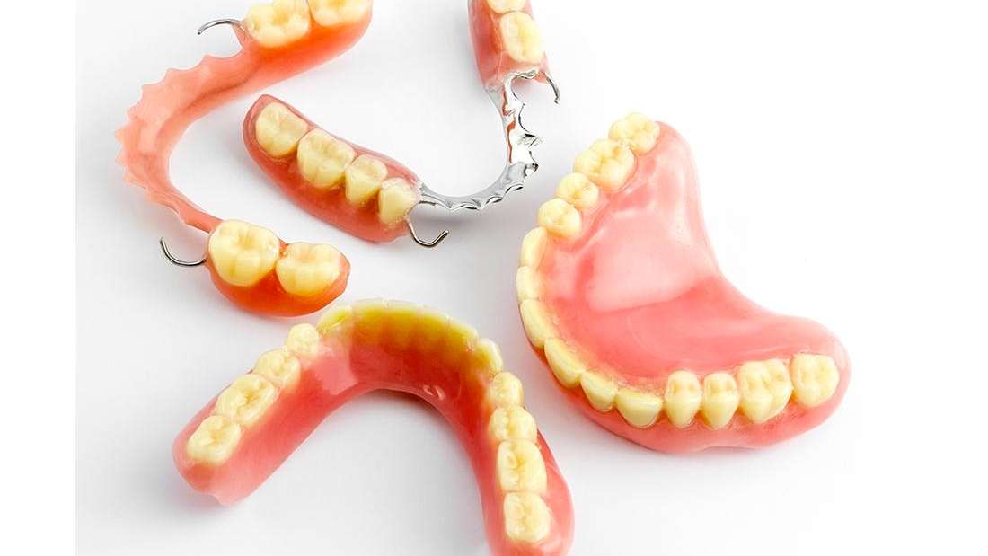Tooth-Brain Connection: What’s Your Best Tooth Replacement Option?